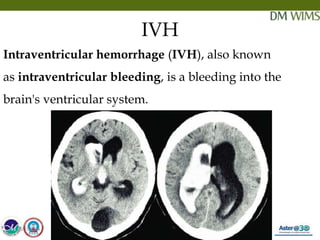 ich , types and clinica featrue , treatment | PPT