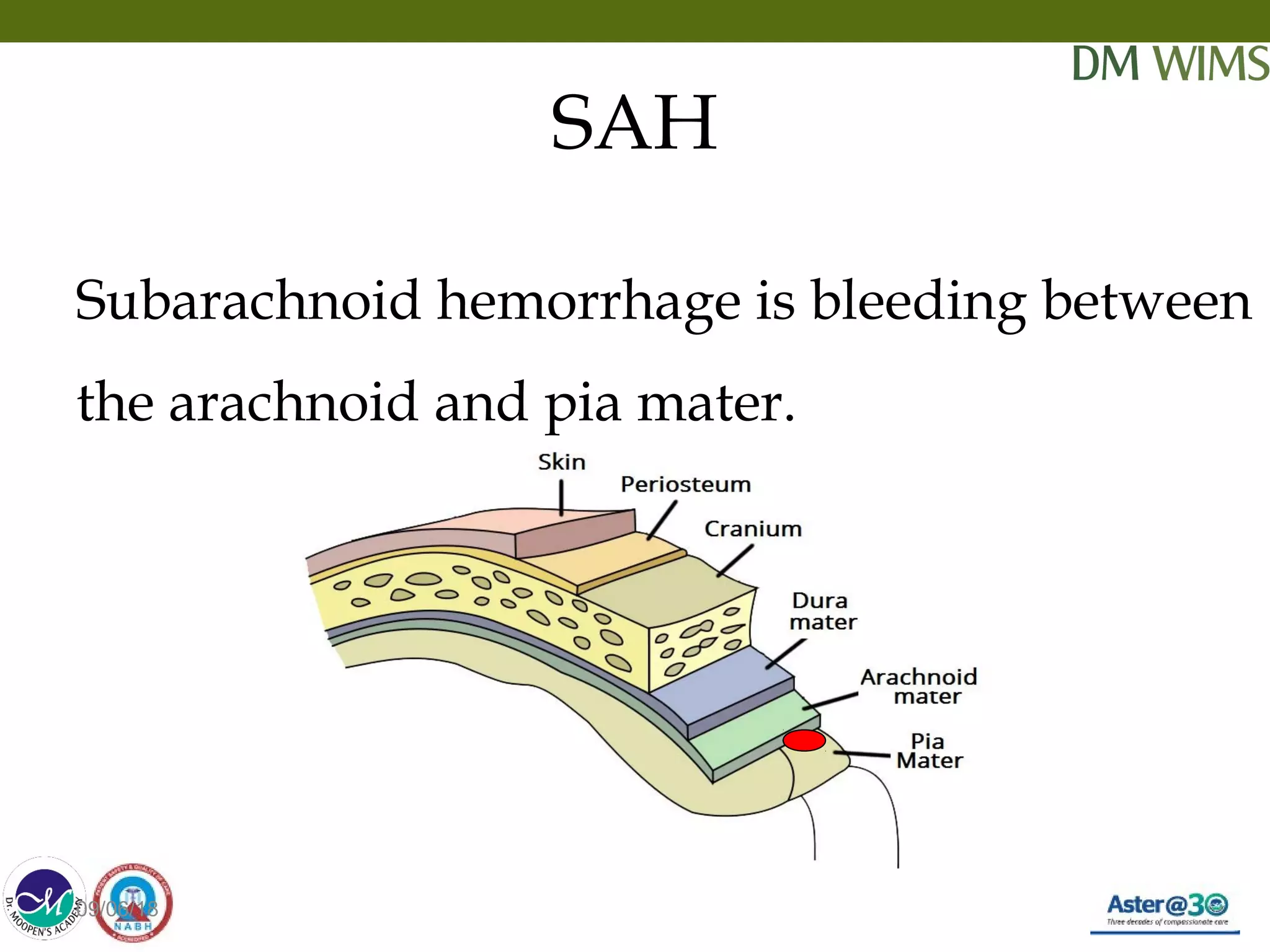 Intracranial hemorrhage,intracerebral Hemorrhage,Brain Bleed | PPT
