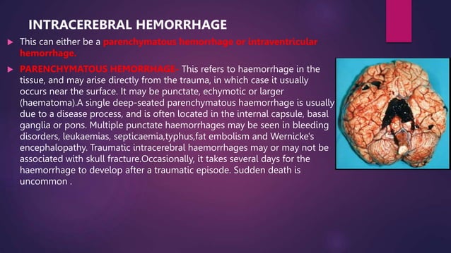 INTRACRANIAL HEMORRHAGE powerpoint presentation | PPTX
