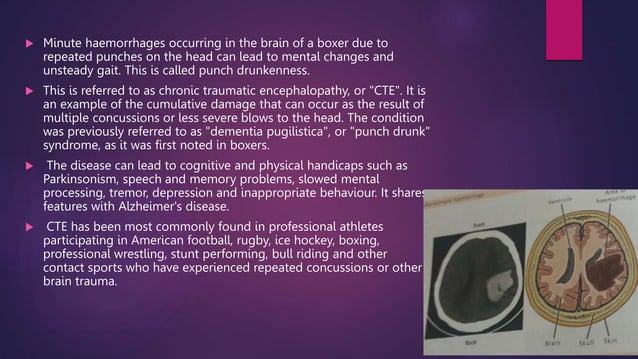 INTRACRANIAL HEMORRHAGE powerpoint presentation | PPTX