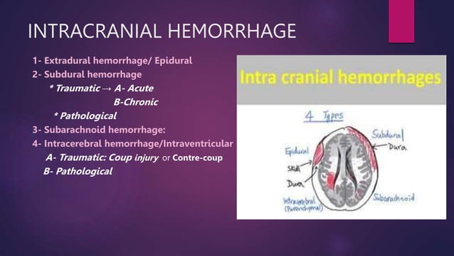 INTRACRANIAL HEMORRHAGE powerpoint presentation | PPTX