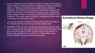 INTRACRANIAL HEMORRHAGE powerpoint presentation | PPTX