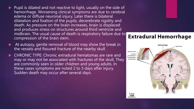 INTRACRANIAL HEMORRHAGE powerpoint presentation | PPTX