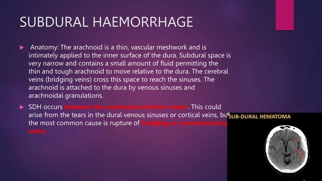 INTRACRANIAL HEMORRHAGE powerpoint presentation | PPTX