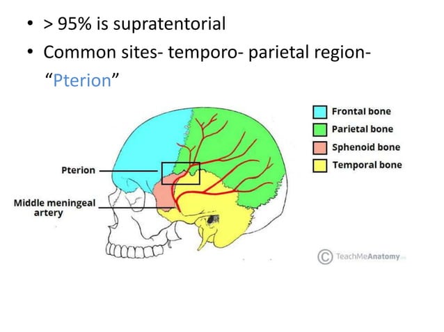 Intra cranial hemorrhages agp | PPTX