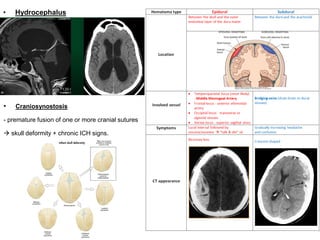 Intracranial Hypertension In Children-2025.pdf