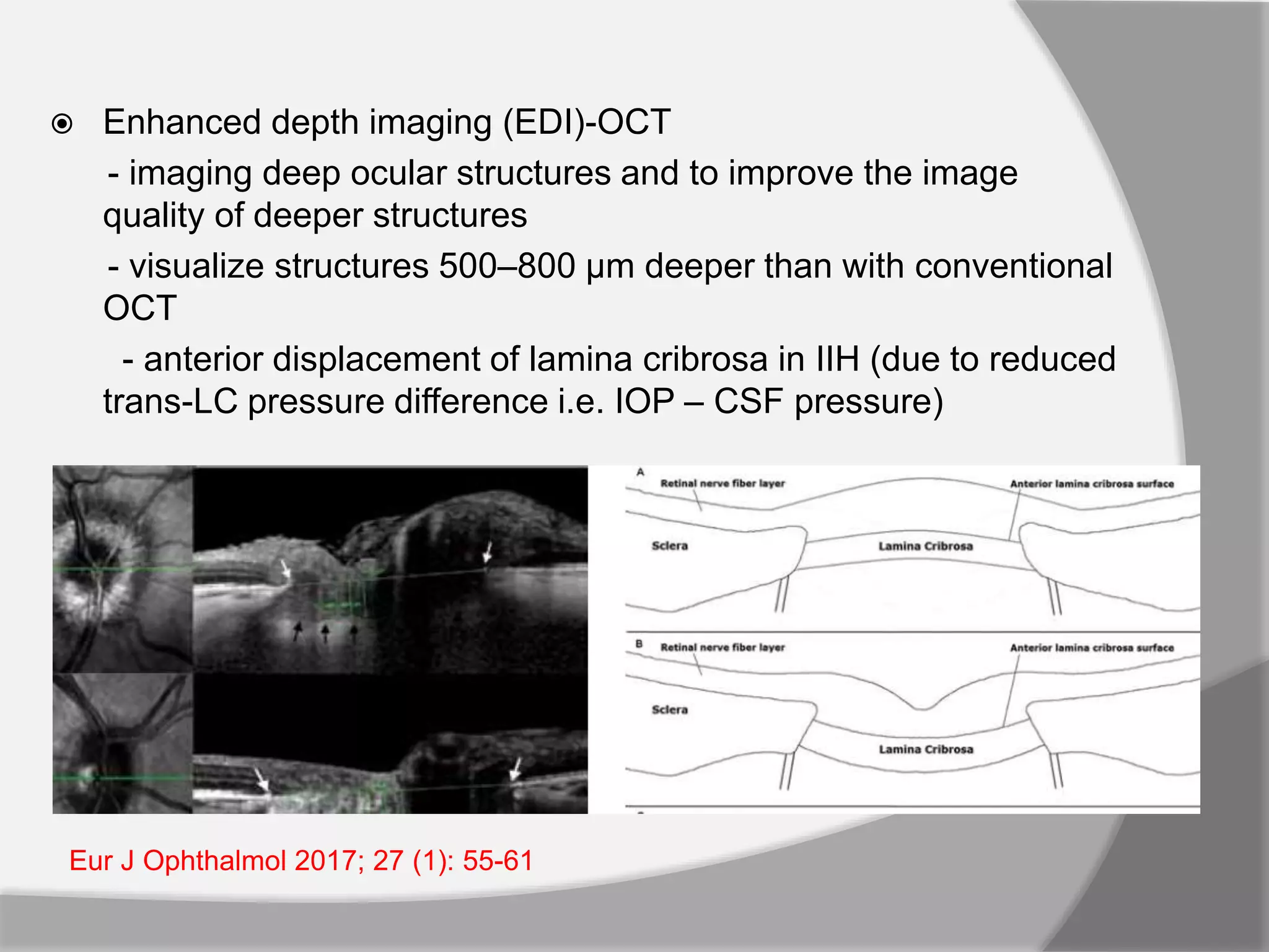 Intracranial hypertension | PPTX
