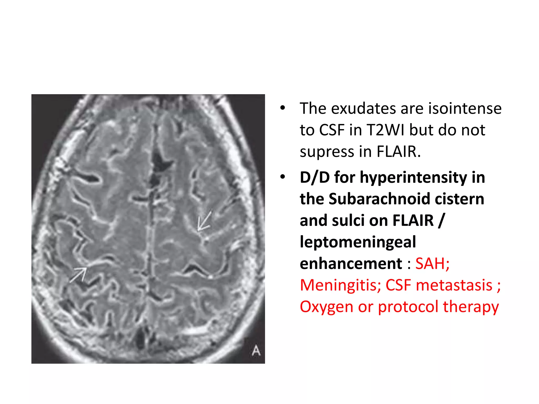 Intracranial infections | PPT