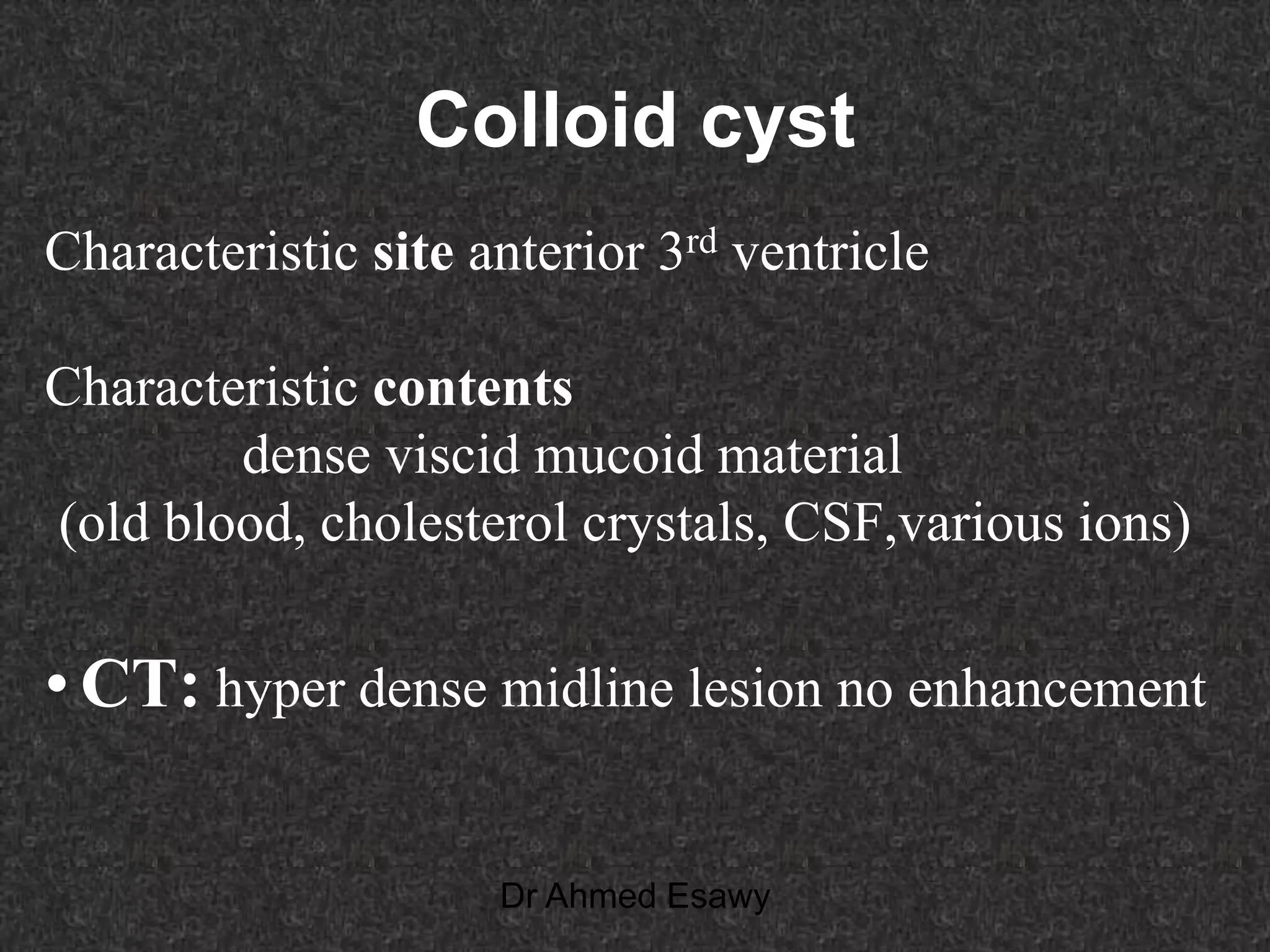 Intracranial non neoplastic cystic lesion Dr Ahmed Esawy CT MRI part 5 ...