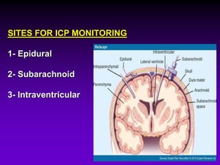 intracranialpressure.ppt