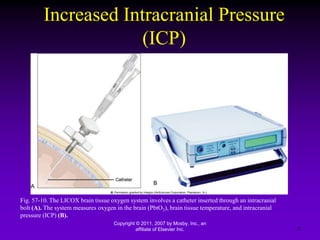intracranialpressure.ppt