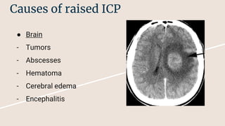 INTRACRANIAL PRESSURE- pathogenesis and management | PPTX