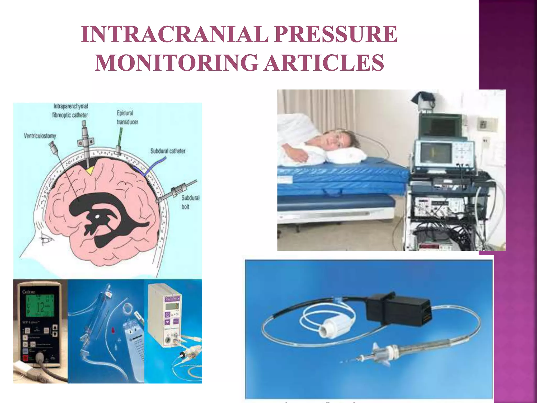 Intracranial pressure measurement | PPTX