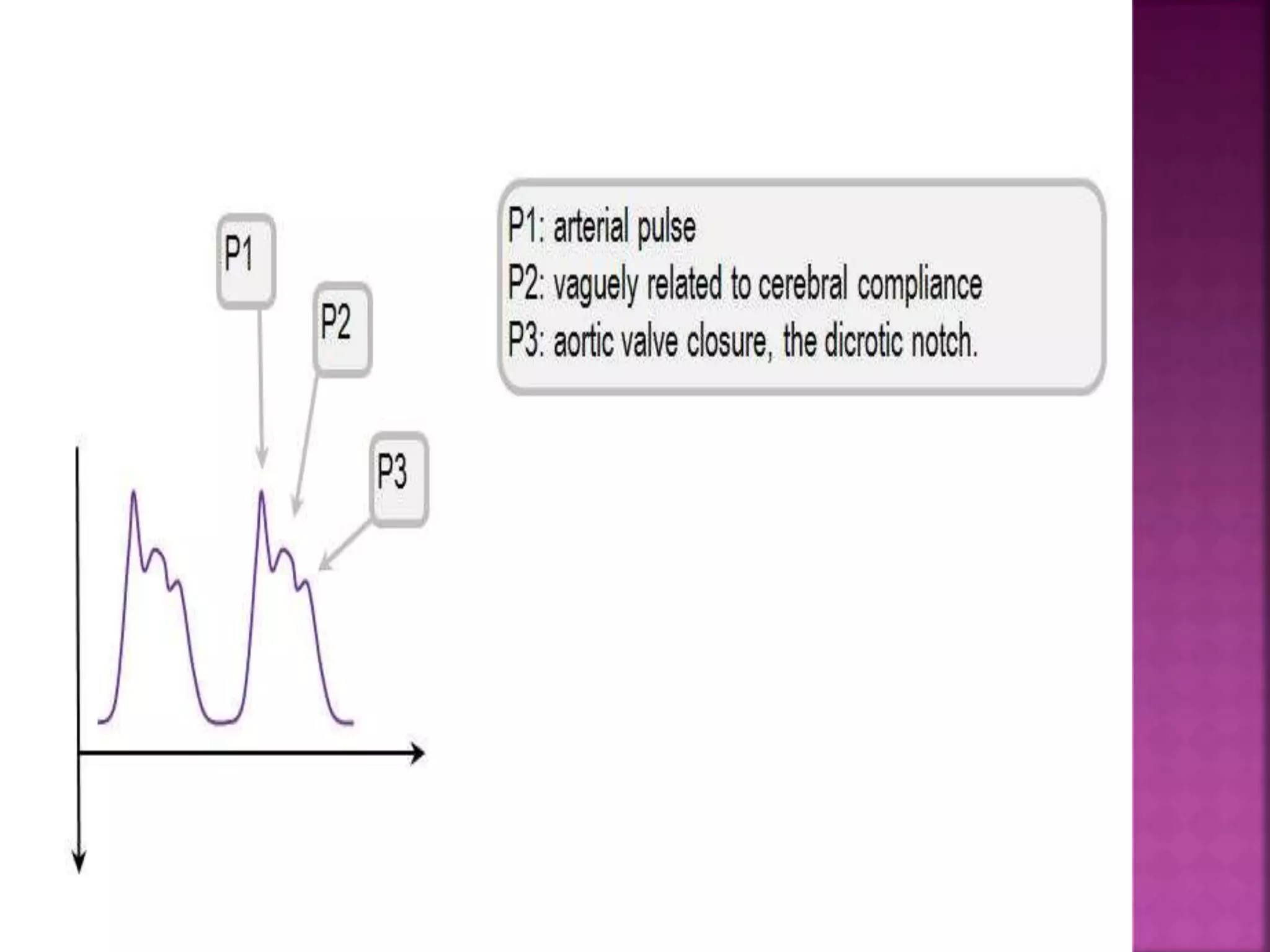 Intracranial pressure measurement | PPTX