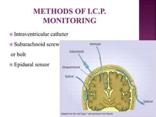 Intracranial pressure measurement | PPTX