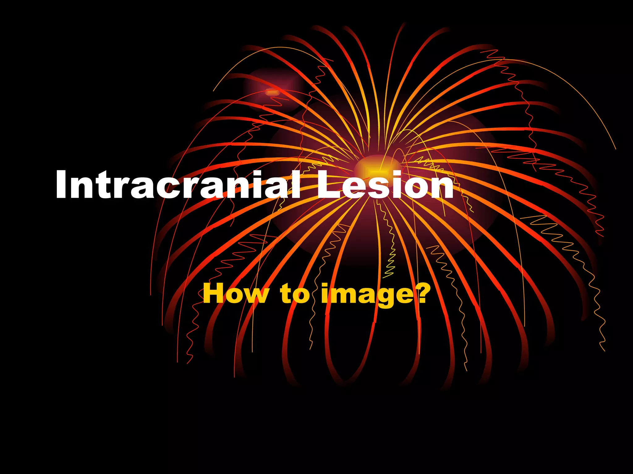 Intracranial radiology general presentation | PPT