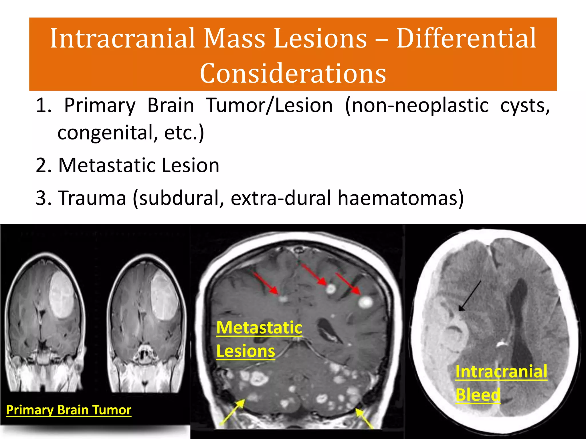 Intracranial space occupying lesions | PPTX