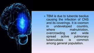 Intracranial tuberculosis | PPTX