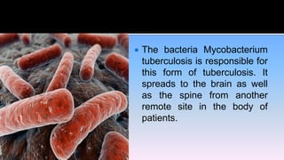 Intracranial tuberculosis | PPTX
