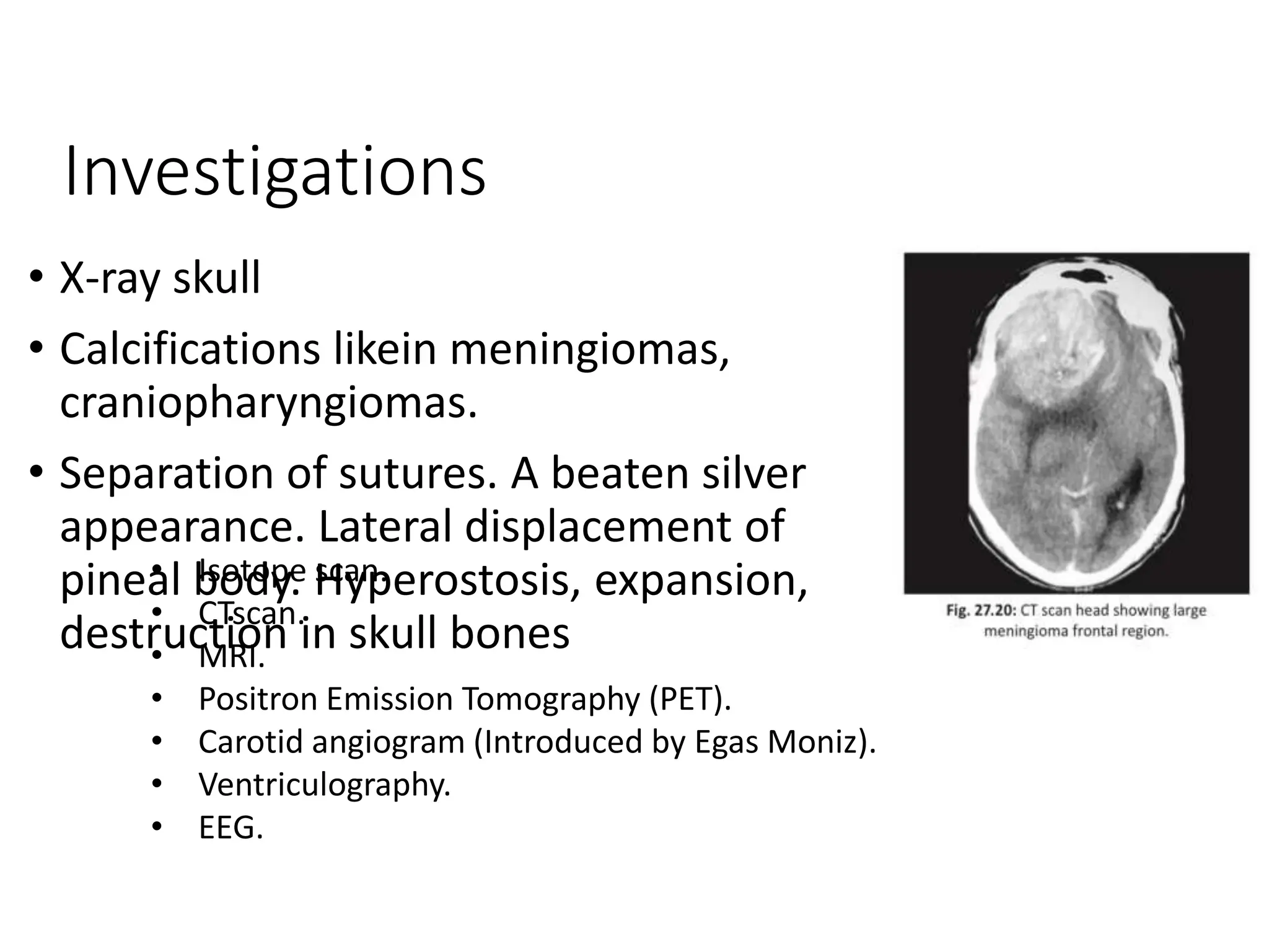 intracranial tumors presentation final.pptx