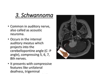 intracranial tumors presentation final.pptx