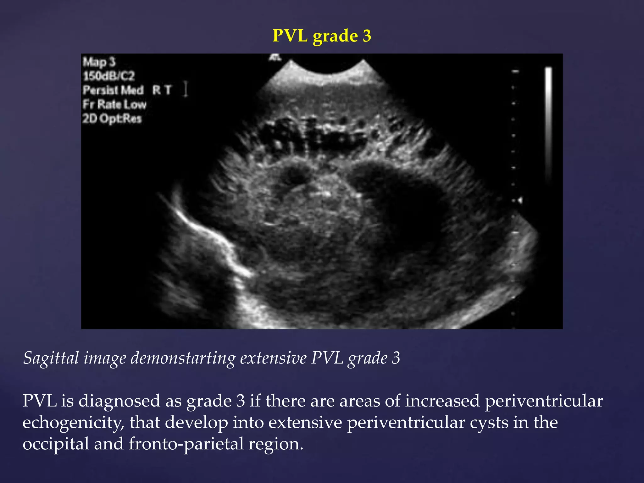 Intracranial ultrasound | PPTX