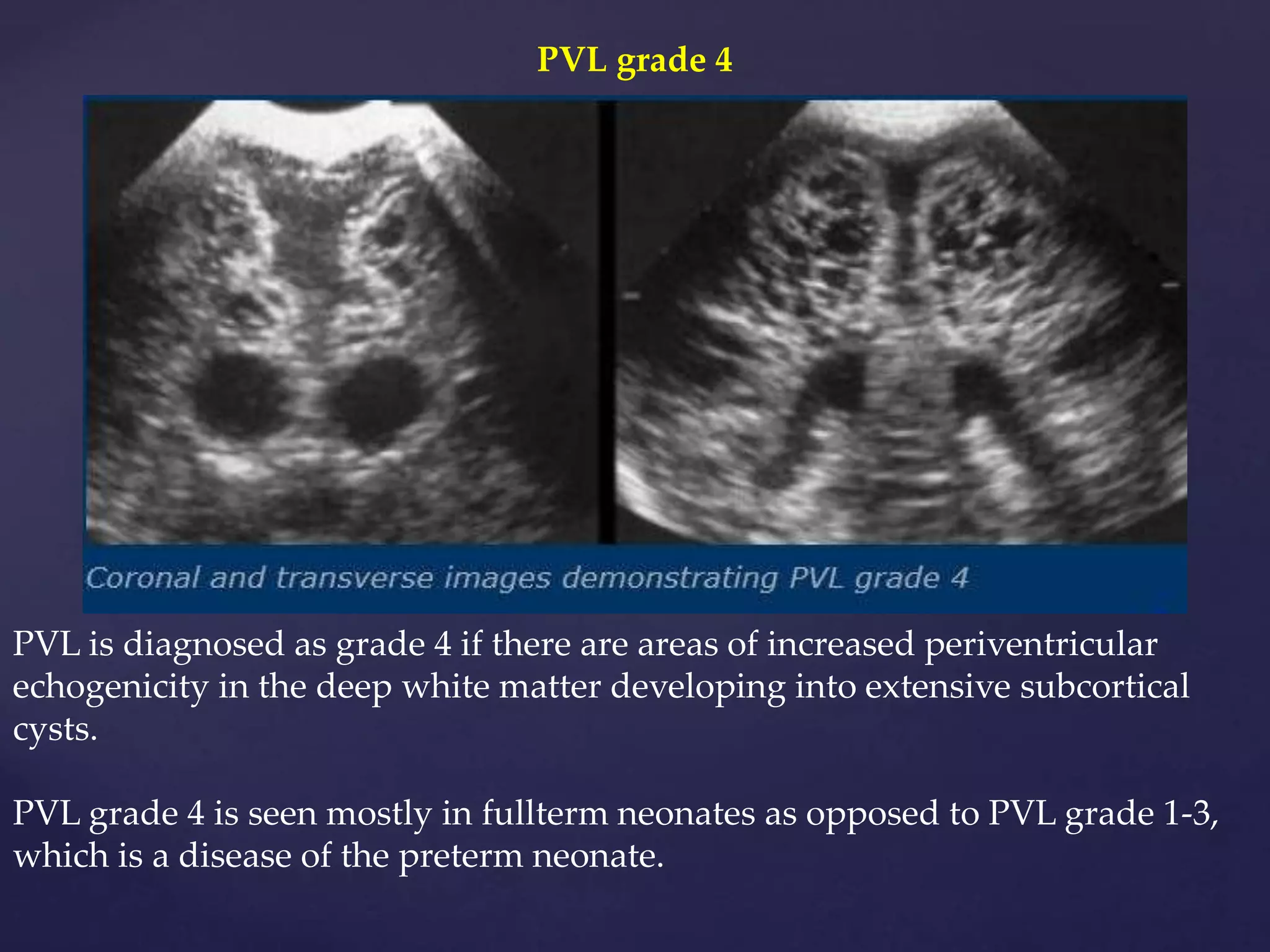 Intracranial ultrasound | PPTX