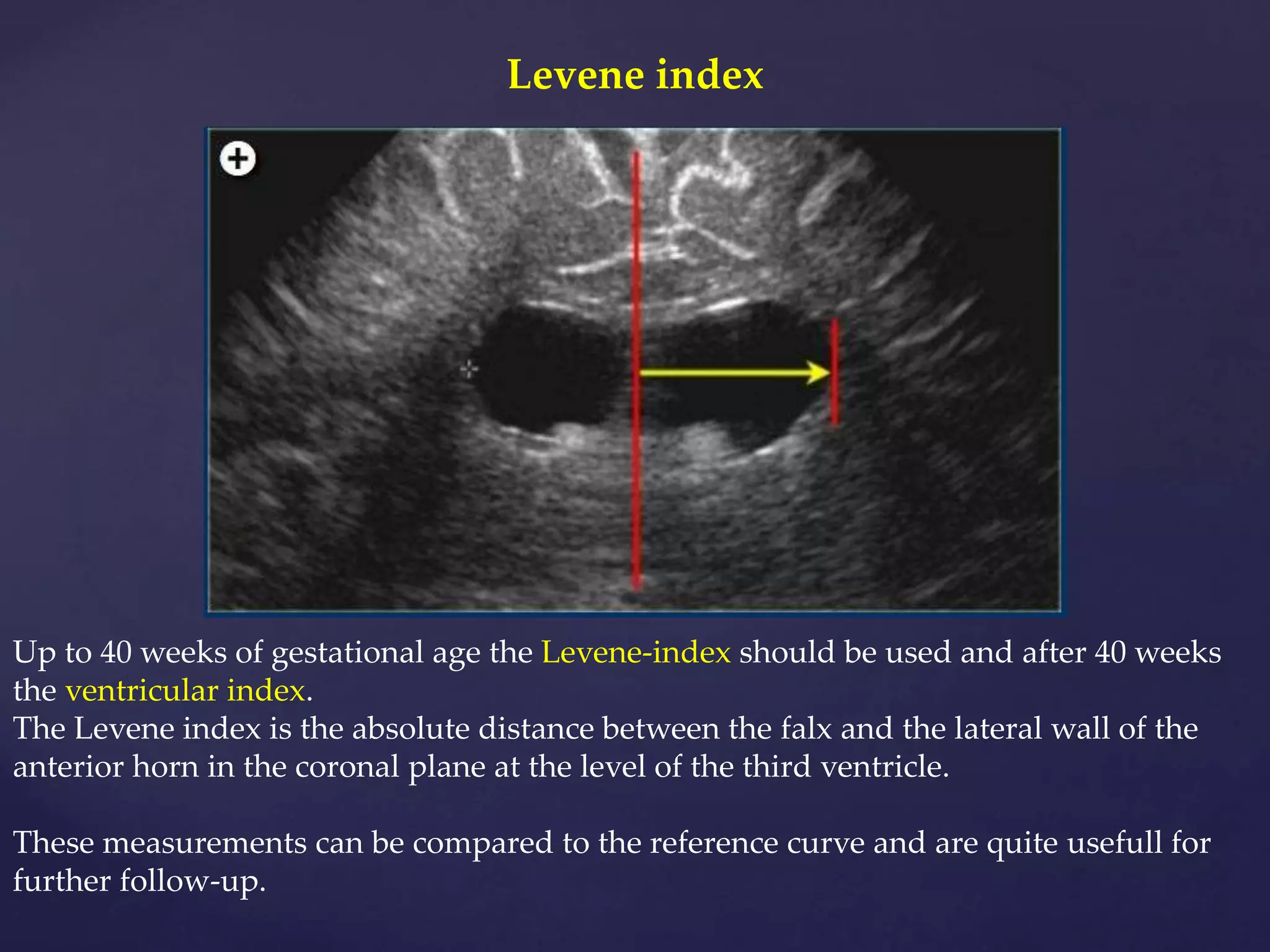 Intracranial ultrasound | PPTX