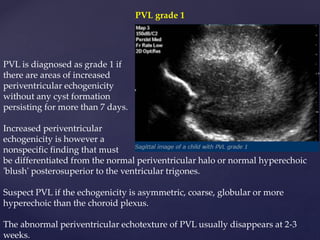 Intracranial ultrasound | PPT