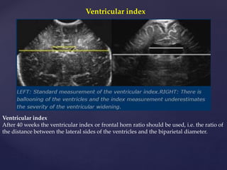 Intracranial ultrasound | PPT
