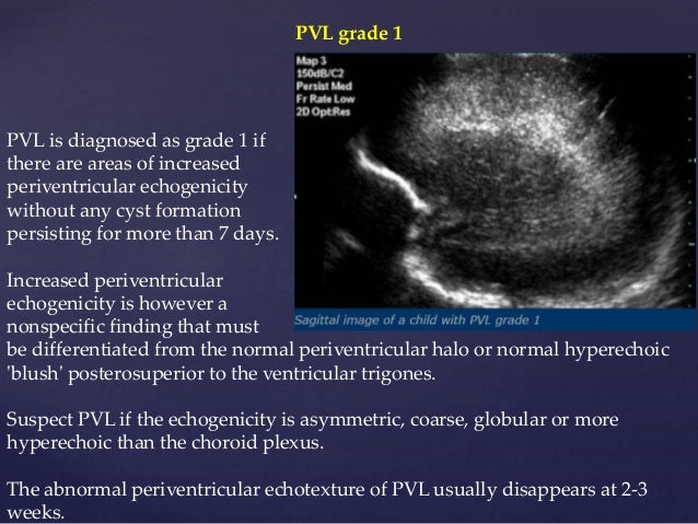 Intracranial ultrasound