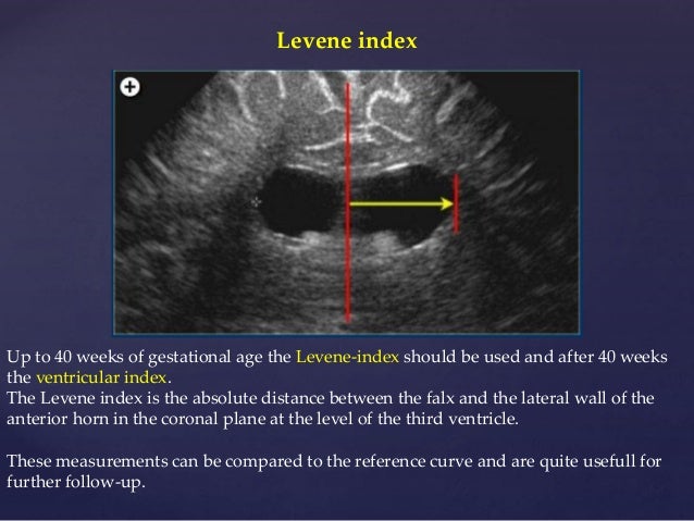 Intracranial ultrasound