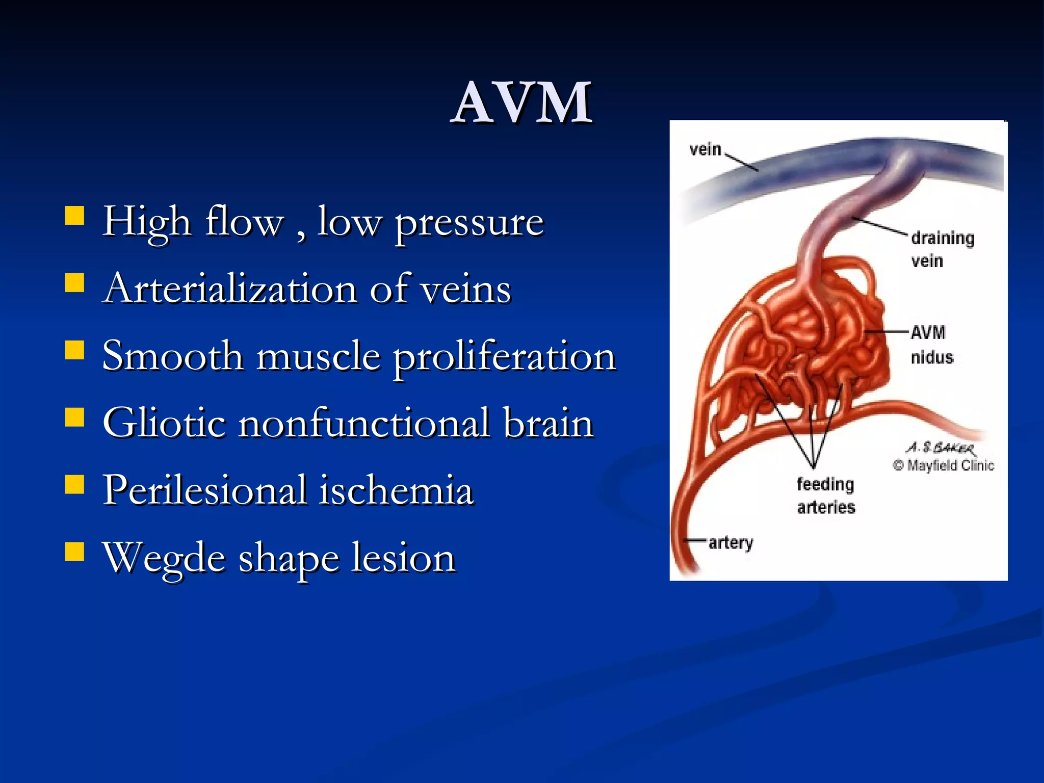 Intracranial vascular disease | PPT