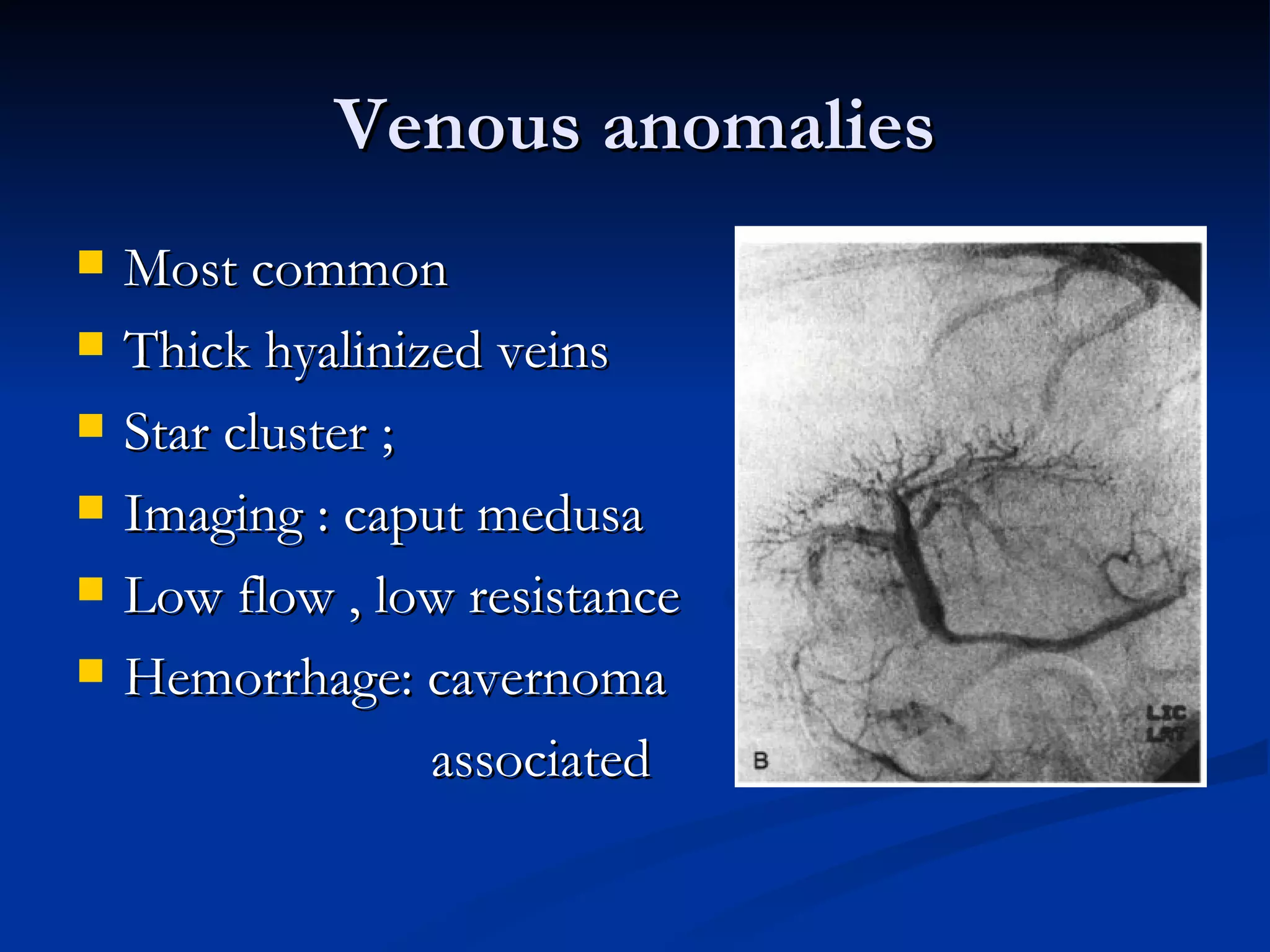 Intracranial vascular disease | PPT