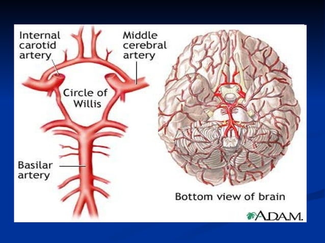 Intracranial vascular disease | PPT | Blood Disorders | Diseases and ...