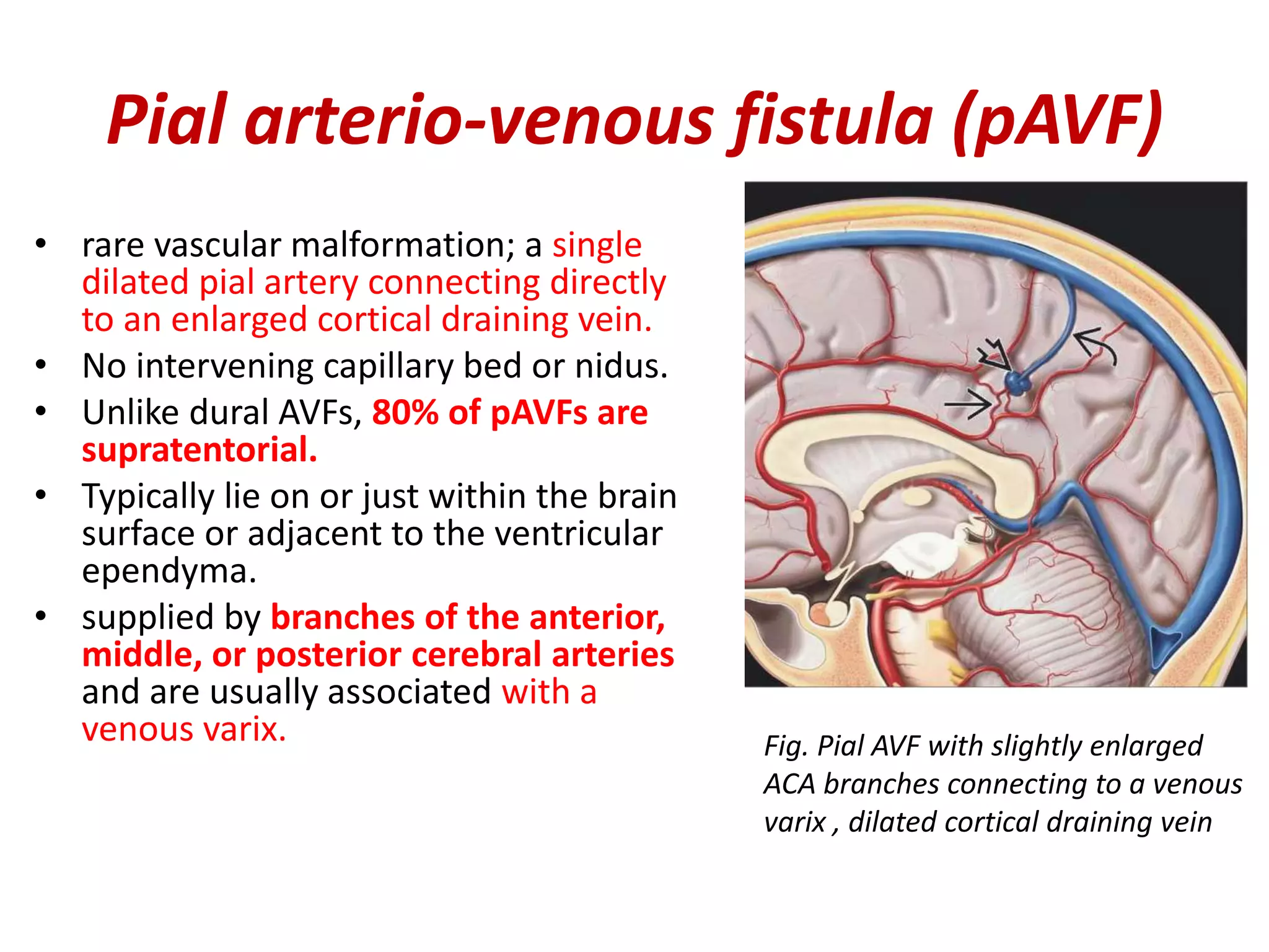 Intracranial vascular malformations | PPTX