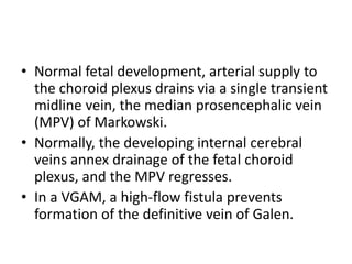 Intracranial vascular malformations | PPTX