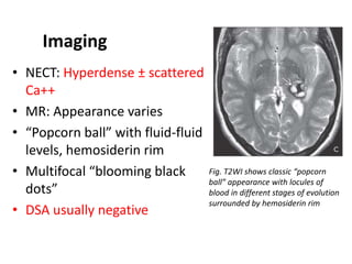 Intracranial vascular malformations | PPTX