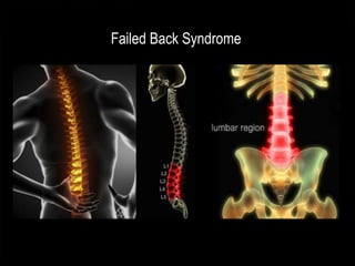 Intractable Pain | PPTX