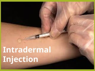 Intradermal-Route-of-Medication-A-Comprehensive-Overview.pptx