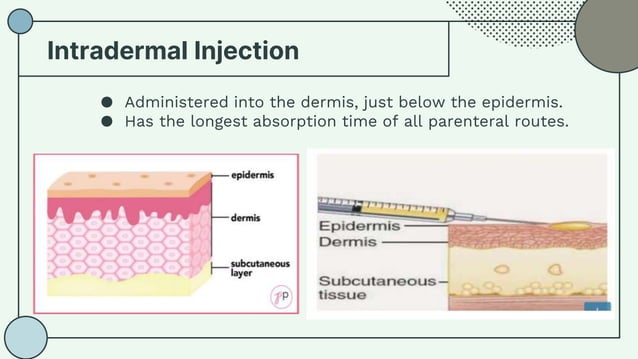Intradermal Immunization .pptx