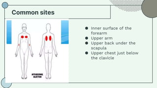 Intradermal Immunization .pptx