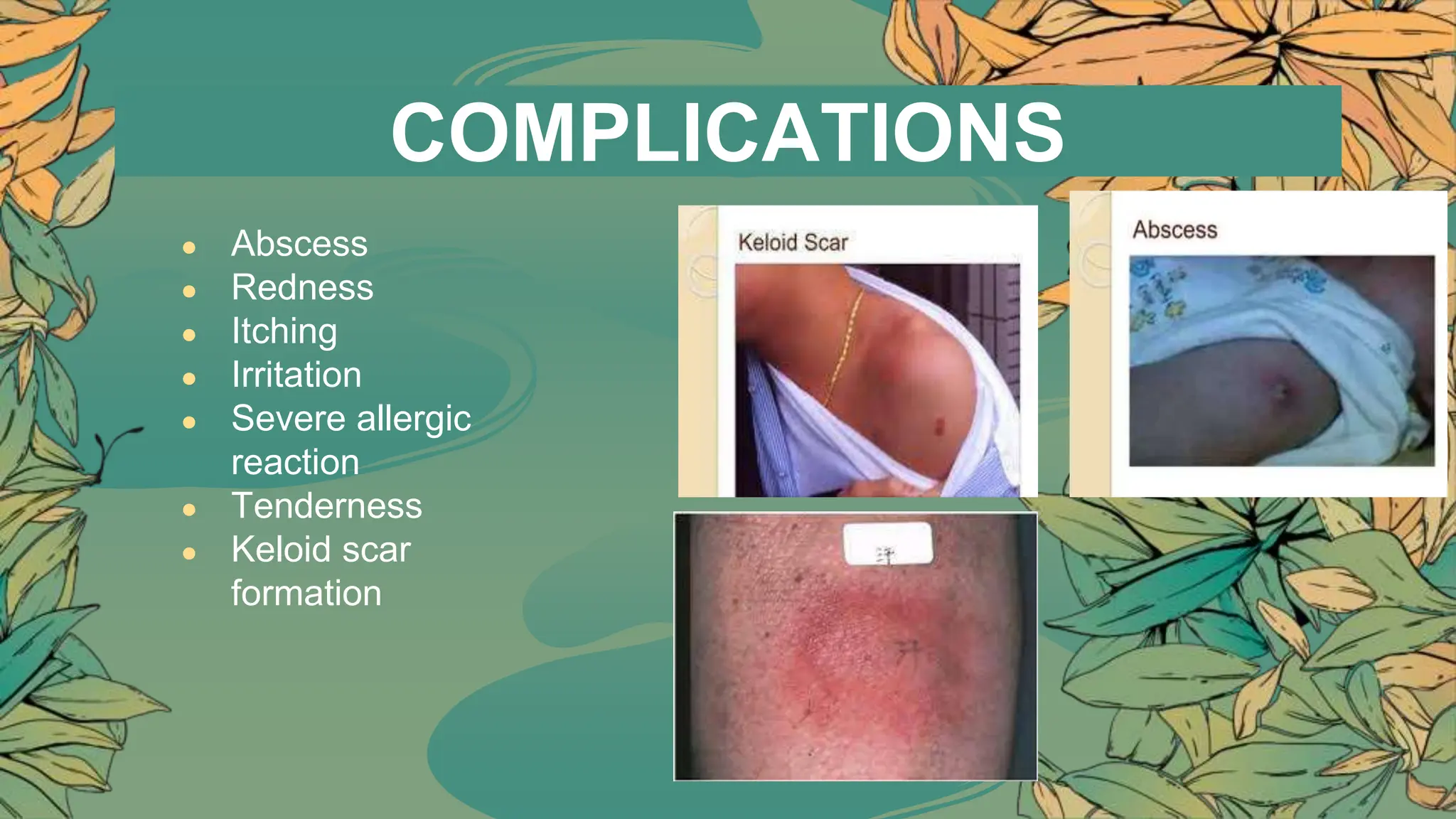 INTRADERMAL INJECTION DESCRIPTION WITH PROCESS | PPTX