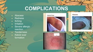 INTRADERMAL INJECTION DESCRIPTION WITH PROCESS | PPTX