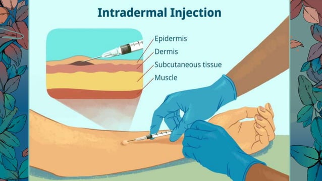 INTRADERMAL INJECTION DESCRIPTION WITH PROCESS | PPTX