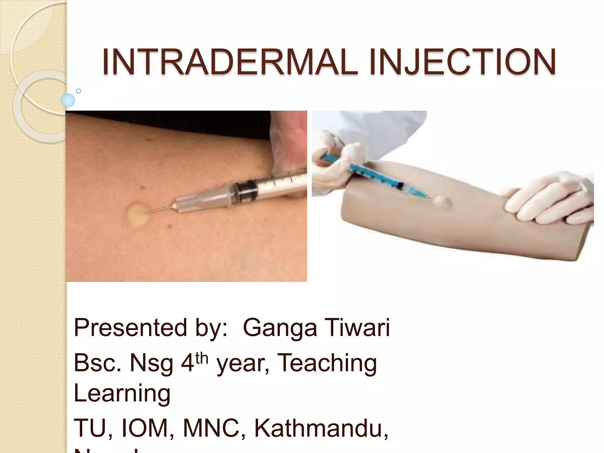 Intradermal injection- Introduction, procedure,complications | PPTX