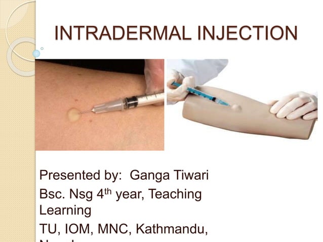 Intradermal injection- Introduction, procedure,complications | PPT