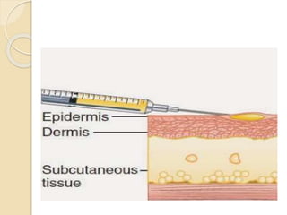 Intradermal Injection