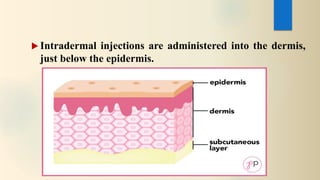 Intradermal injections | PPTX