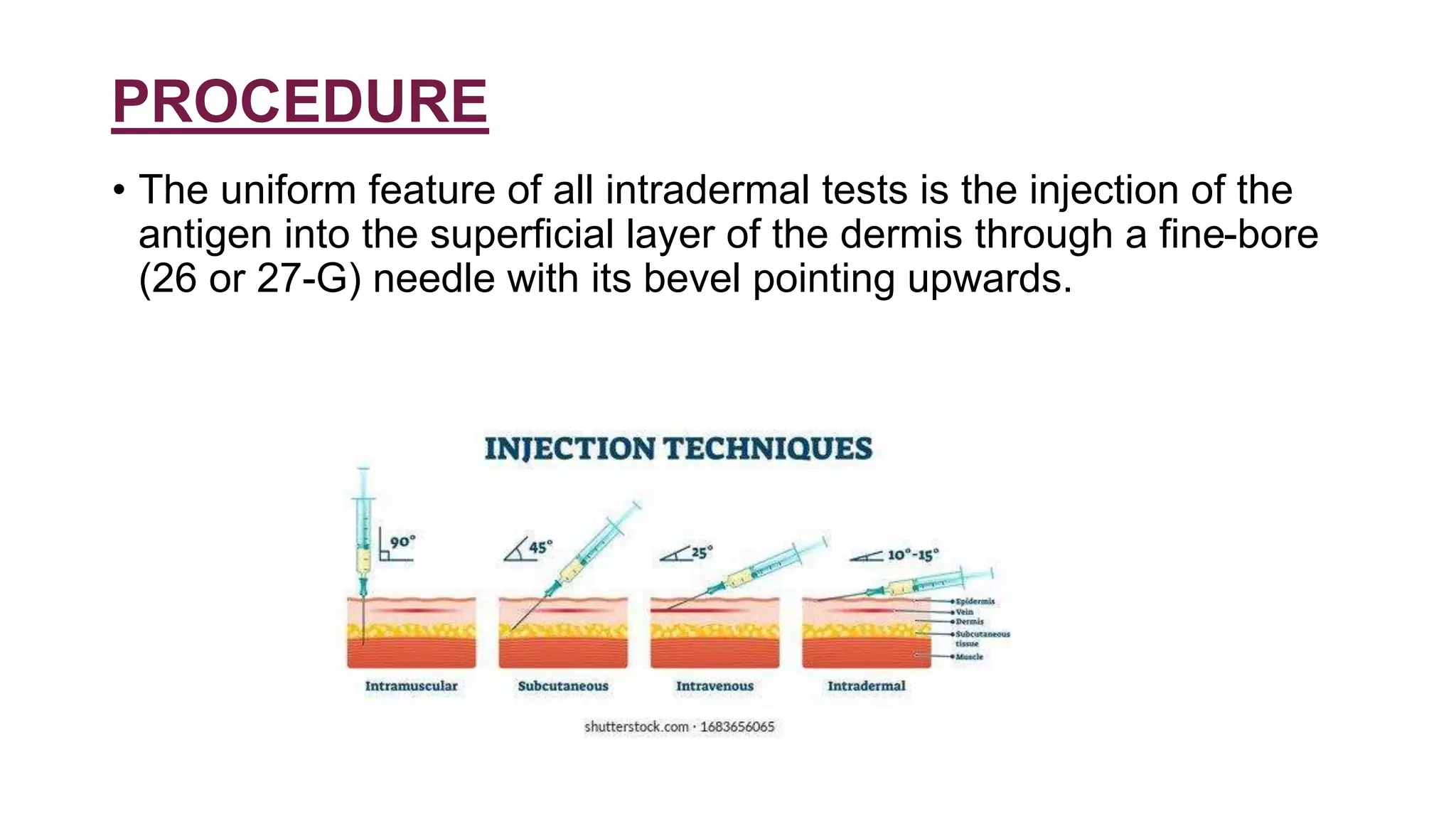 intradermal tests.pptx